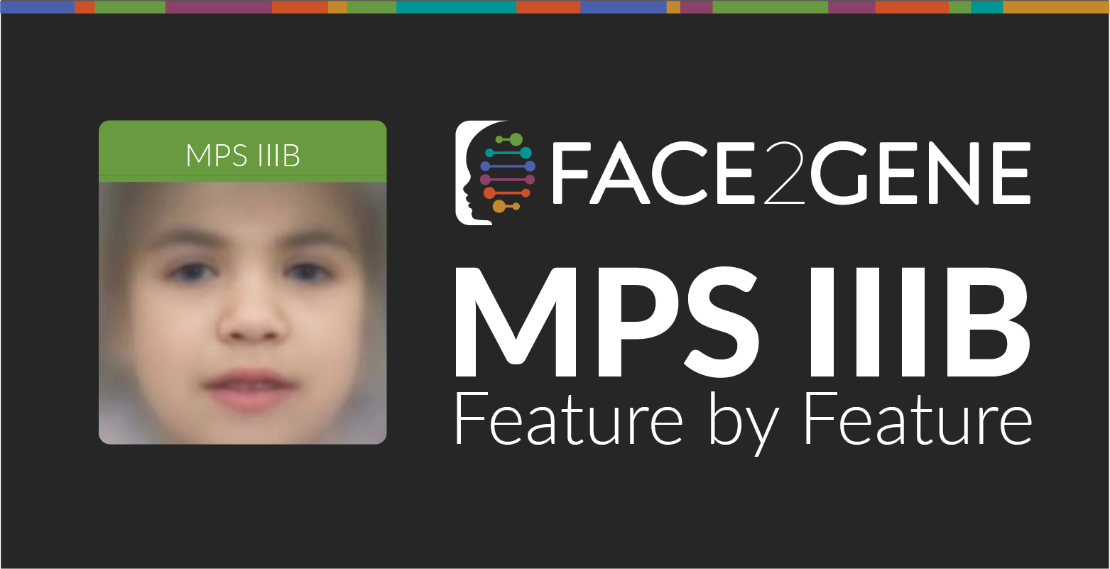 FDNA™ - Facial Analysis Discoveries for Sanfilippo Syndrome B (MPS IIIB)