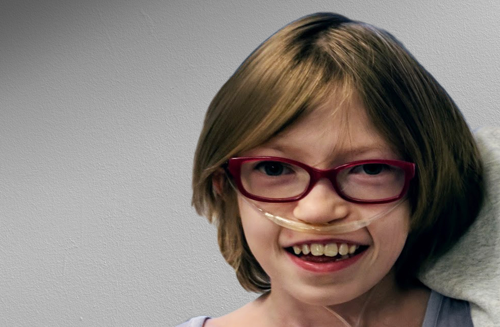 Q 22 Deletion Syndrome The 22q11.2 Region Regulates Presynaptic