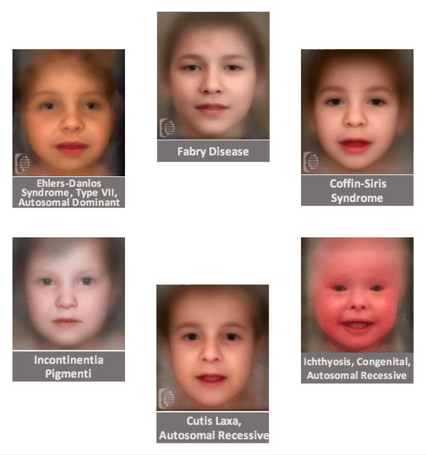 FDNA™ - Skin Disorders Discoveries in the Year of Discovery