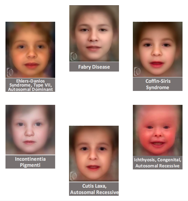 FDNA™ - Skin Disorders Discoveries in the Year of Discovery